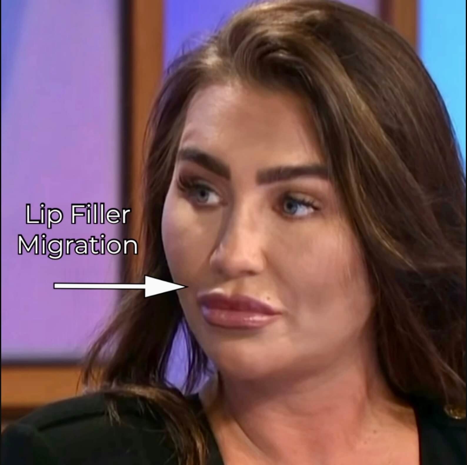 Lip Blushing Gone Wrong: What You Need to Know - Bloomsies